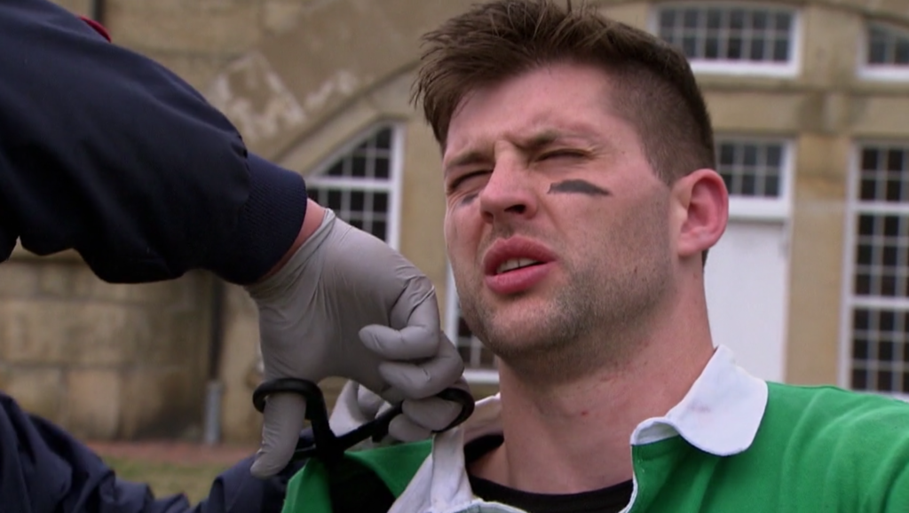 kevin shoulder dislocation bachelorette - Ali Manno (Fedotowsky)
